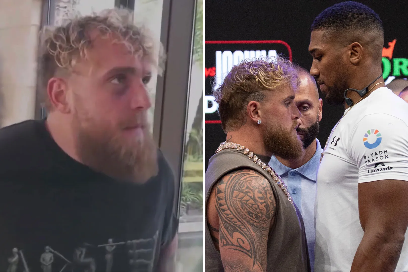 Sparking Controversy And Excitement, Jake Paul Displays Black Eye ...